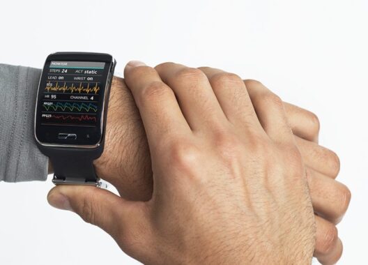 Samsung Simband is a health oriented Gear S on steroids