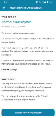 Fitbit Sense review: Is it still worth it?